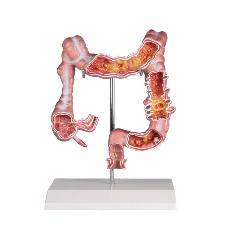Dikke Darm anatomisch model - Medical Art